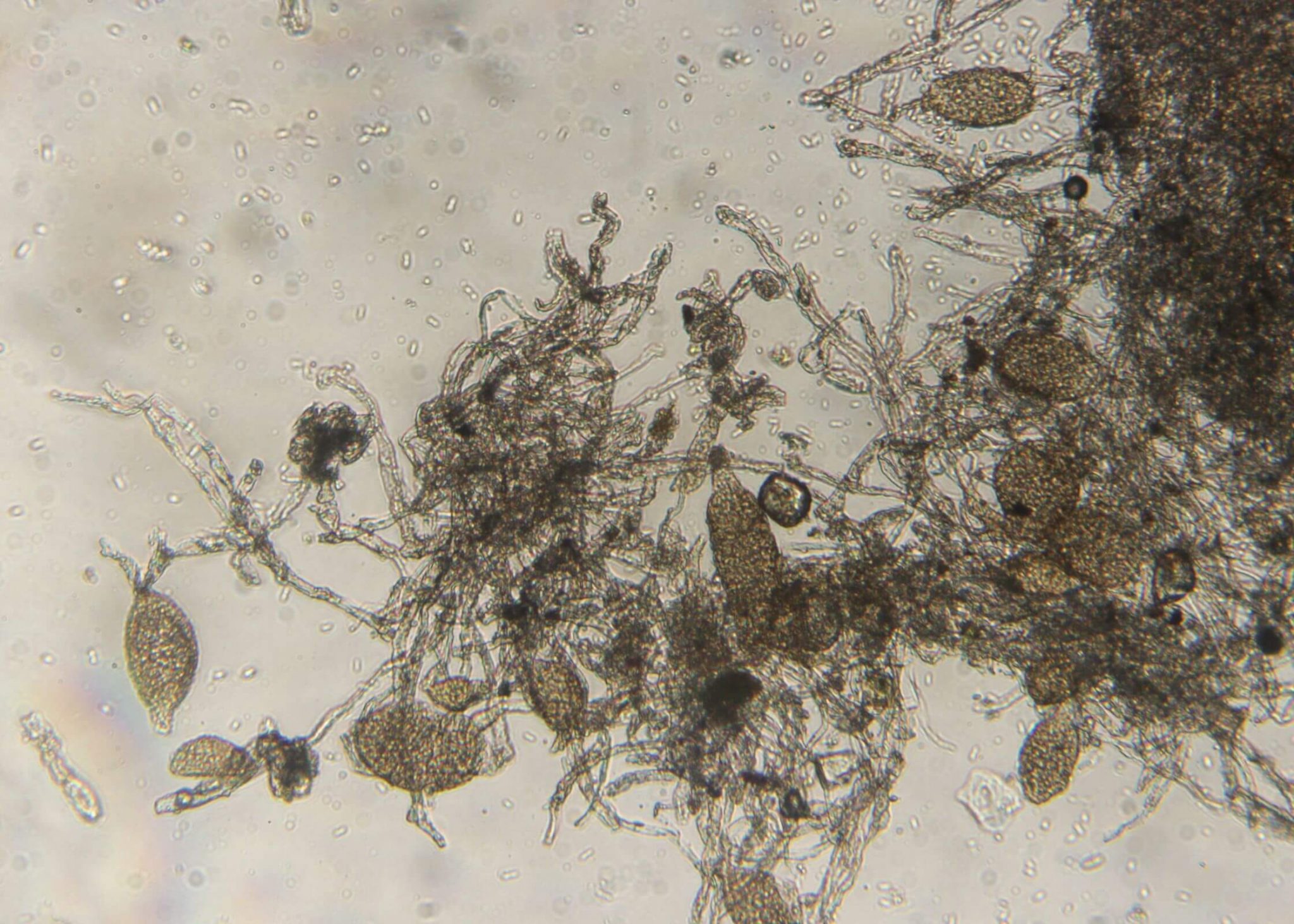 Trichoderma biocontrol agents: uses