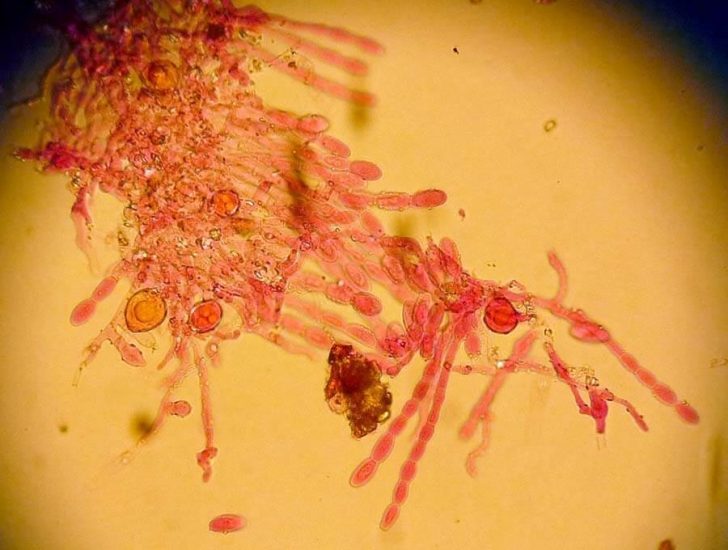 Powdery mildew control: identification, prevention & treatment tips