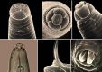 Root-knot nematodes: Impact, detection & sustainable control methods